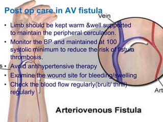 Hemodialysis and care of patients. | PPTX