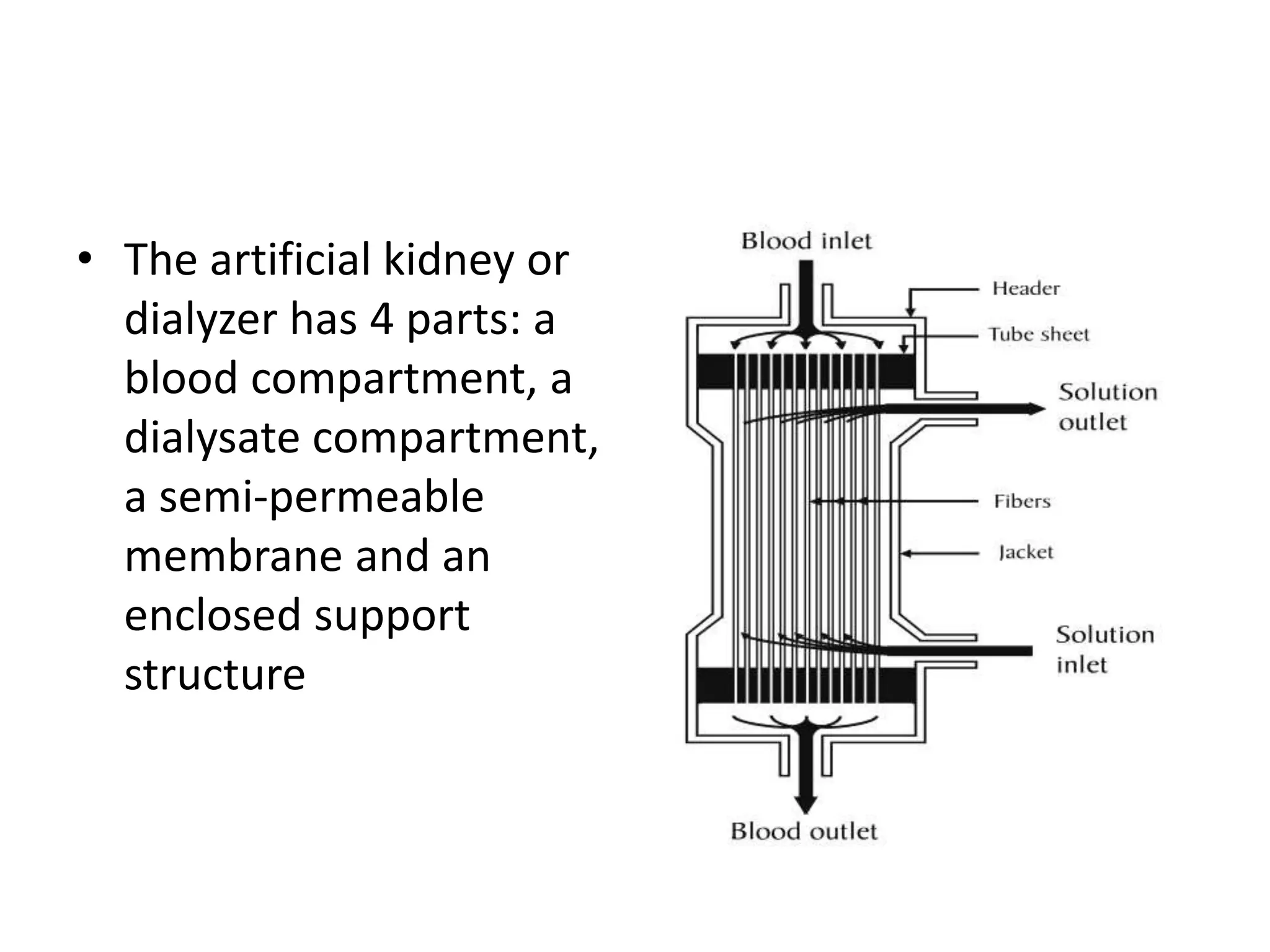 Hemodialysis: management of chronic kidney disease | PPTX