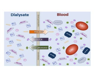 Hemodialysis: management of chronic kidney disease | PPTX