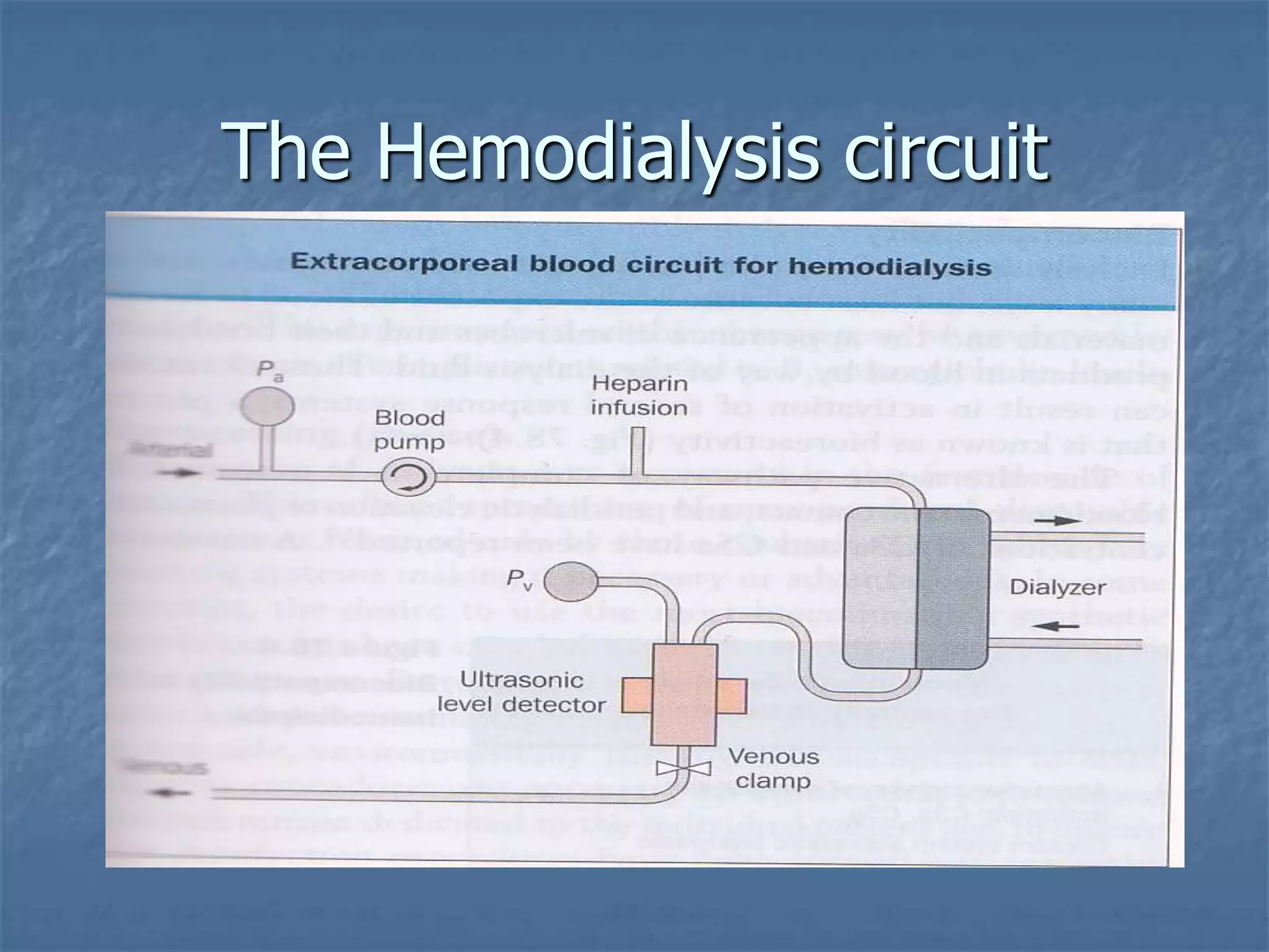 Hemodialysis.ppt