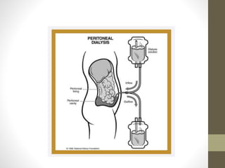 Dialysis step by step.pptx