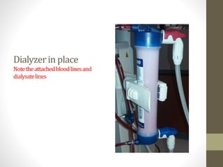 Dialysis step by step.pptx