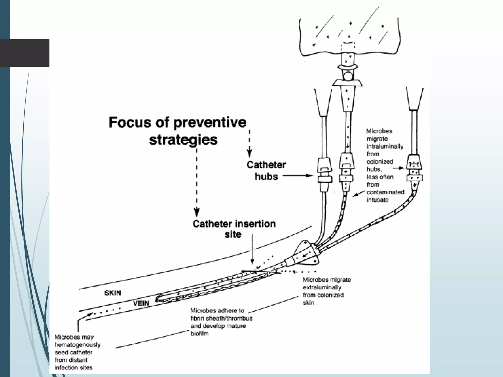 Hemodialysis complications | PPTX