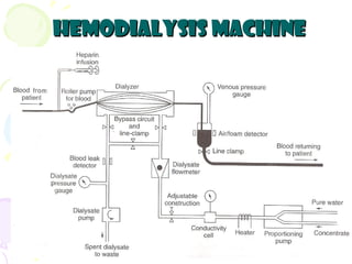 Hemodialysis Diagram