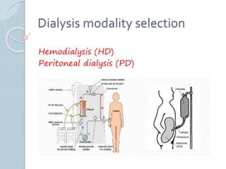 Hemodialysis in children | PPTX
