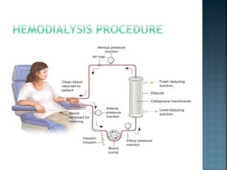 Hemodialysis procedure | PPTX