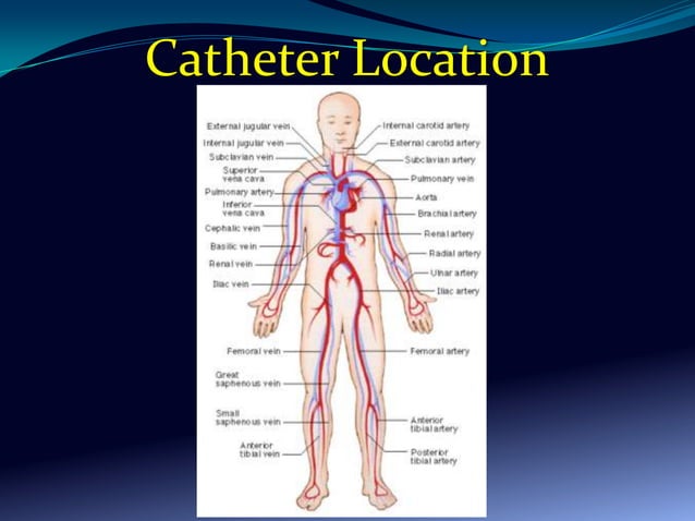 Hemodialysis vascular catheters review