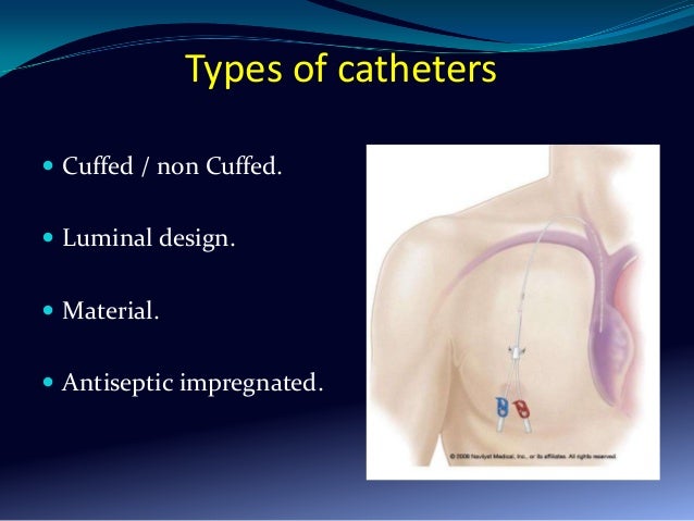 Hemodialysis vascular catheters review