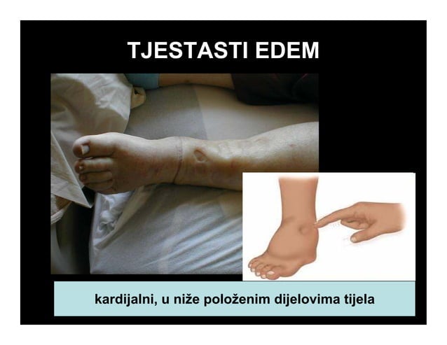 Hemodinamika | PPT