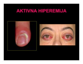 Hemodinamika | PDF