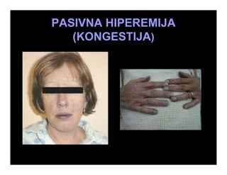 Hemodinamika | PDF