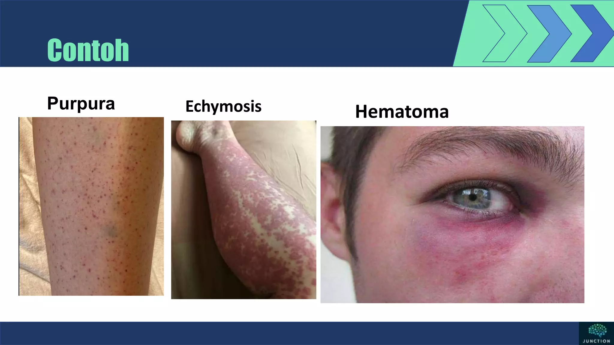 HEMODINAMIKA 1.pptx