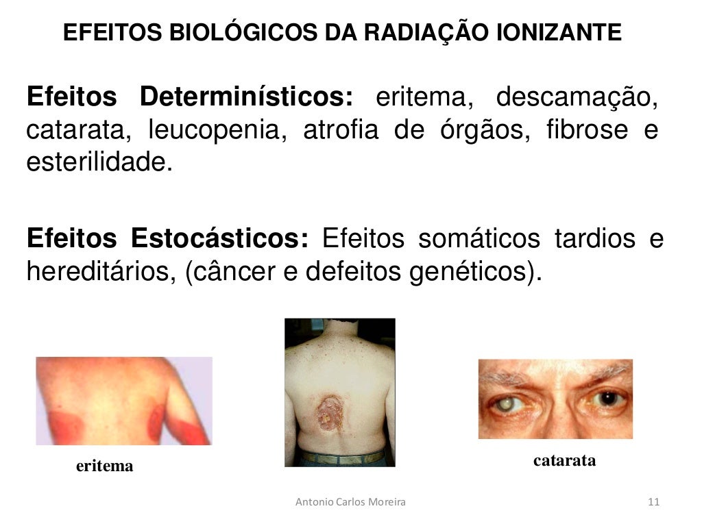 Efeito Determinístico E Estocástico - BRAINCP