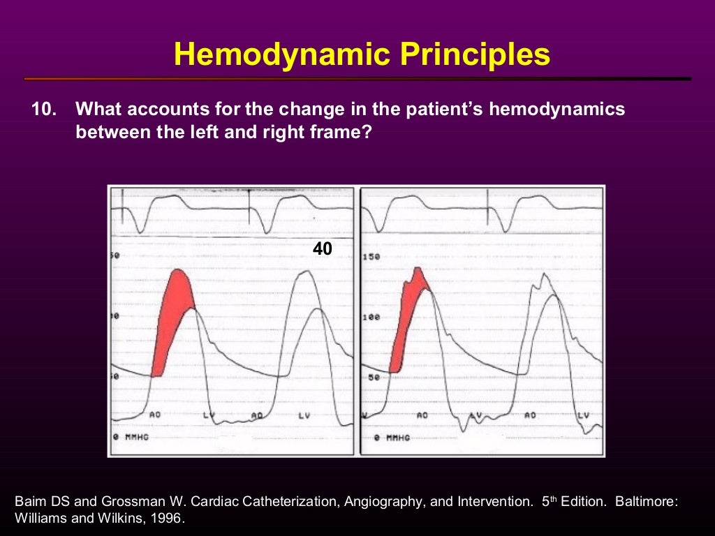 Hemodynamic