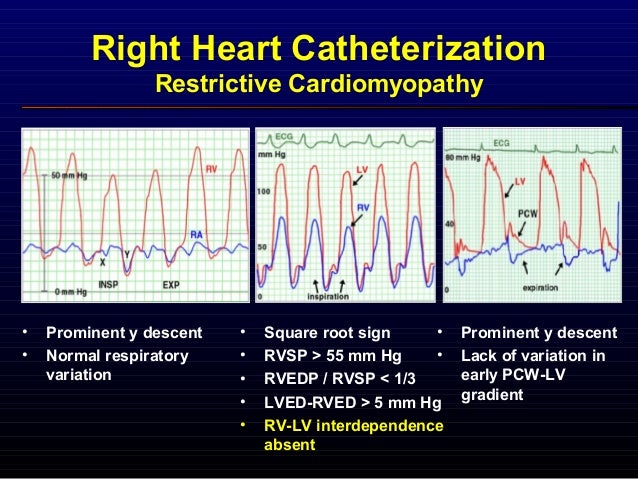 Hemodynamic