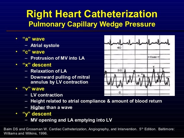 Hemodynamic