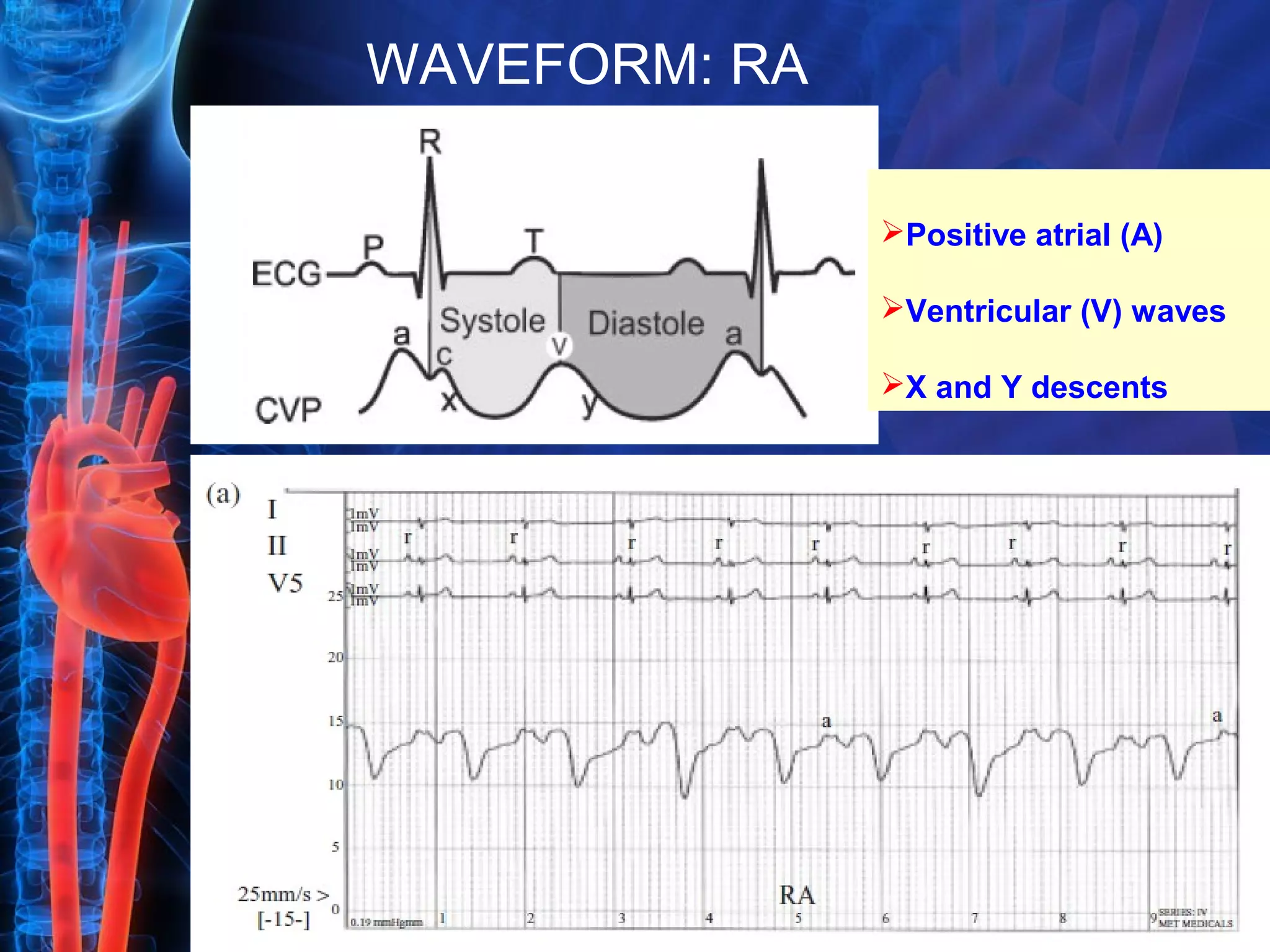 Hemodynamic | PPT