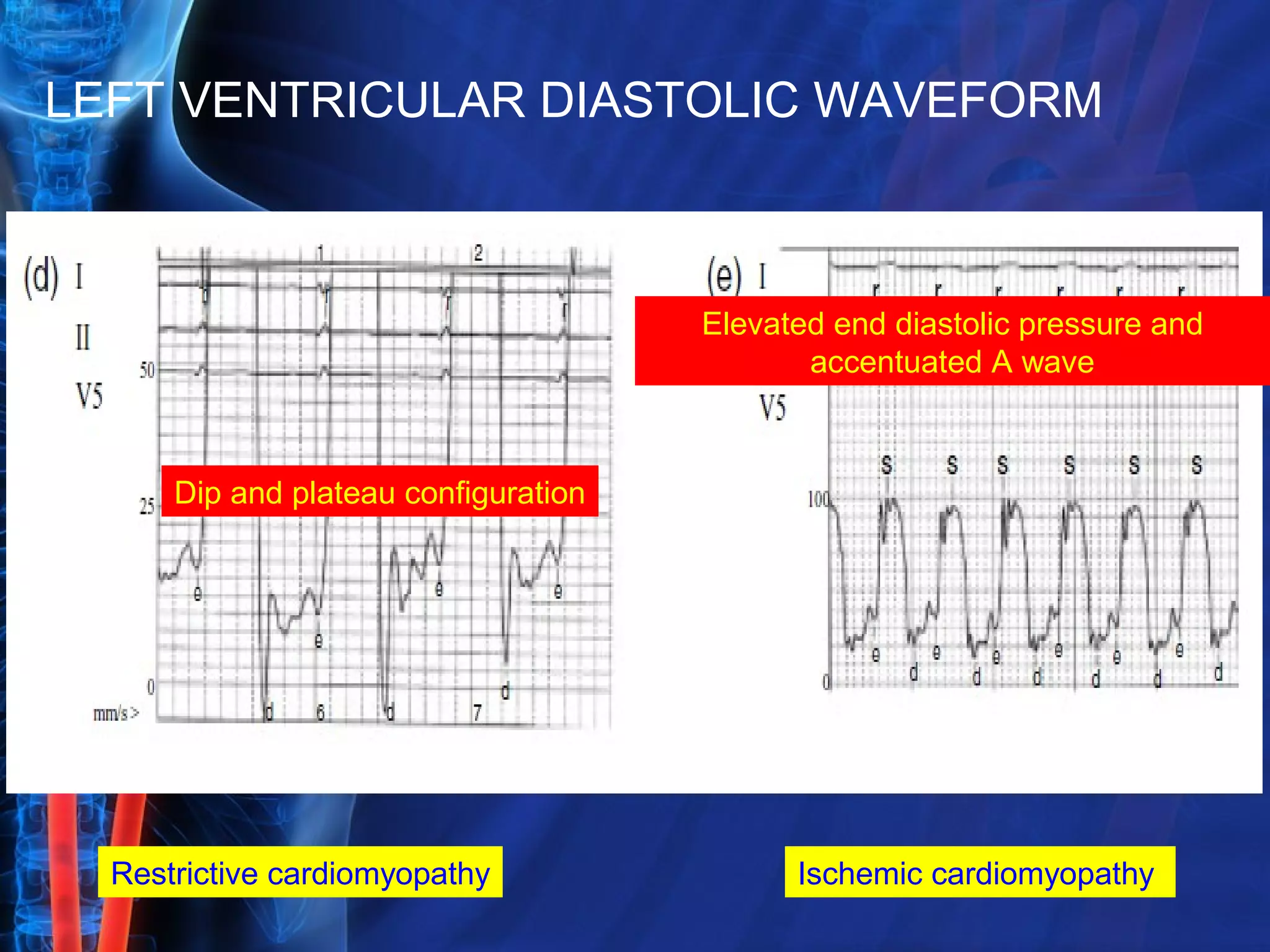 Hemodynamic | PPT