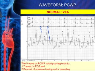 Hemodynamic | PPT | Heart and Cardiovascular Diseases | Diseases and ...