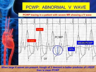 Hemodynamic | PPT