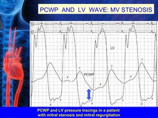 Hemodynamic | PPT