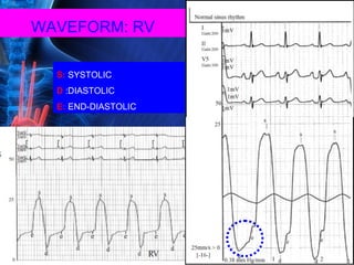 Hemodynamic | PPT
