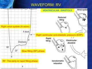 Hemodynamic | PPT