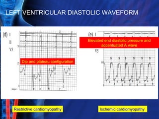 Hemodynamic | PPT