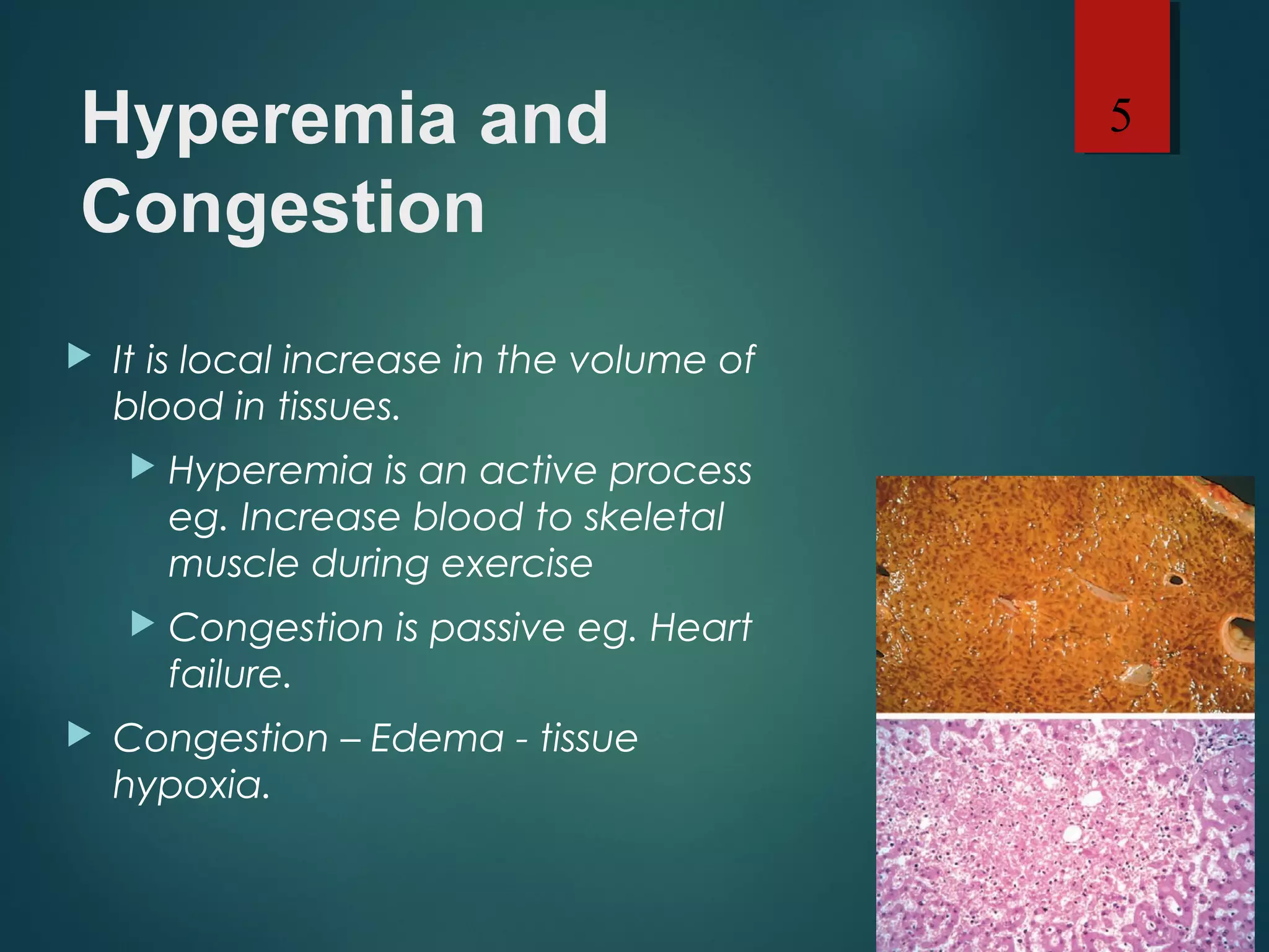 Hemodynamic disorders | PPT