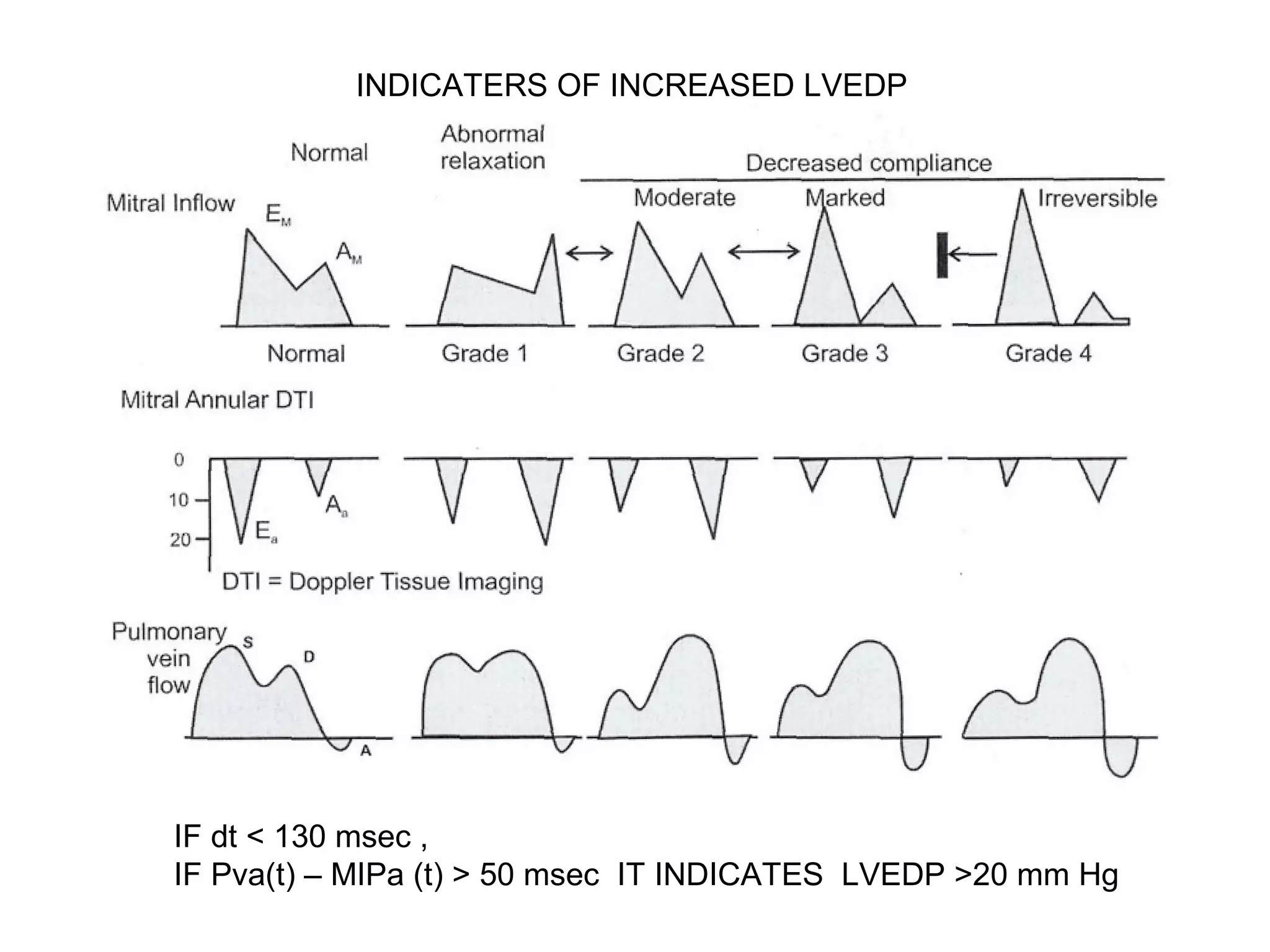 Hemodynamic Assessment by Echocardiography | PPT