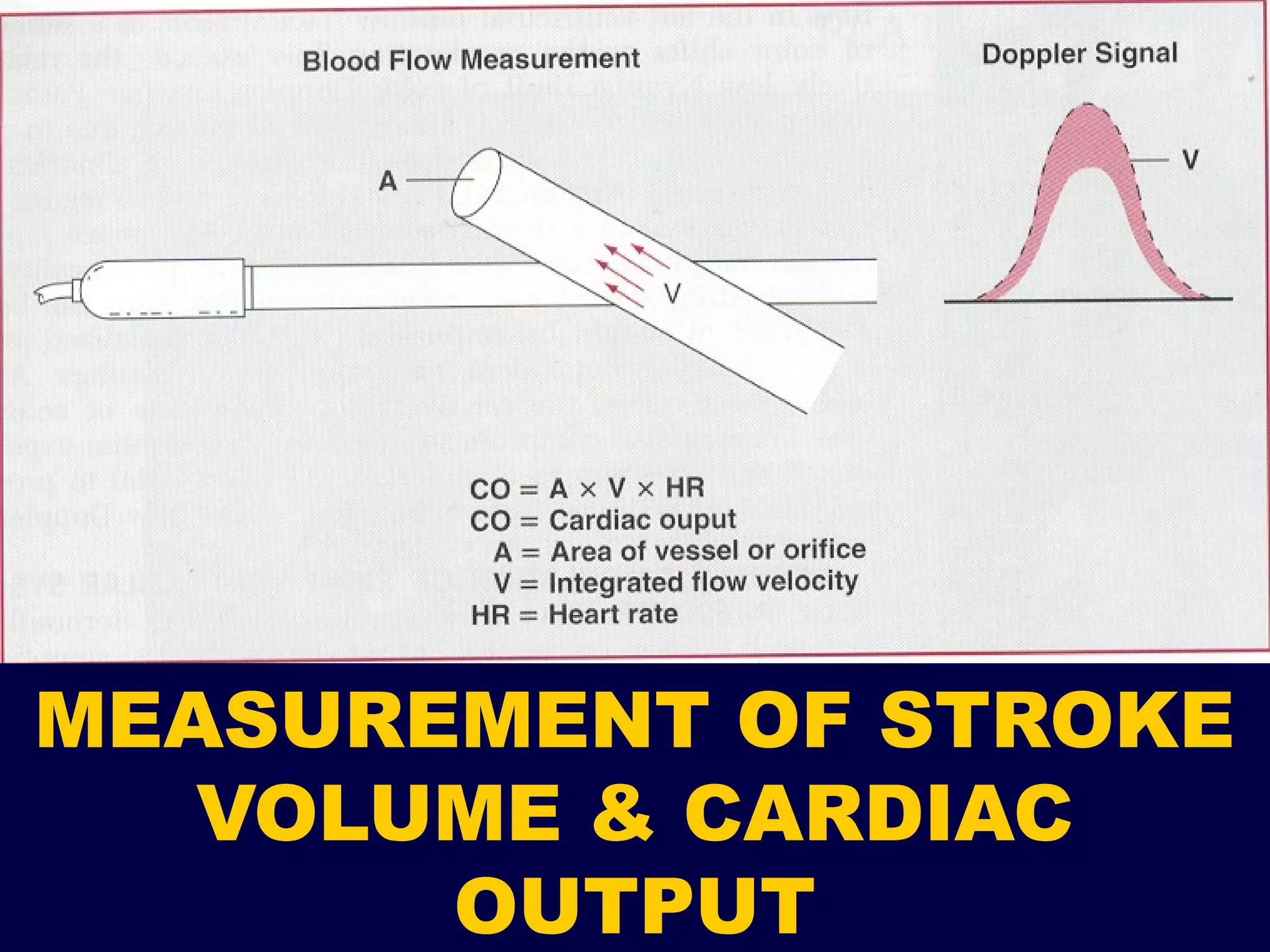 Hemodynamic assessment in cardiology | PPT