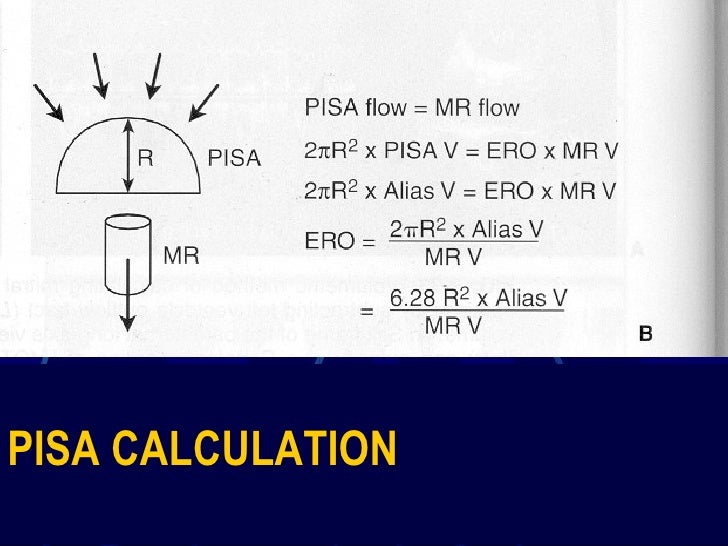 Hemodynamic assessment in cardiology