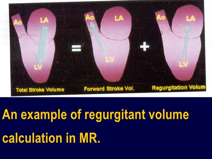 Hemodynamic assessment in cardiology