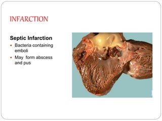 Hemodynamic disorders | PPTX