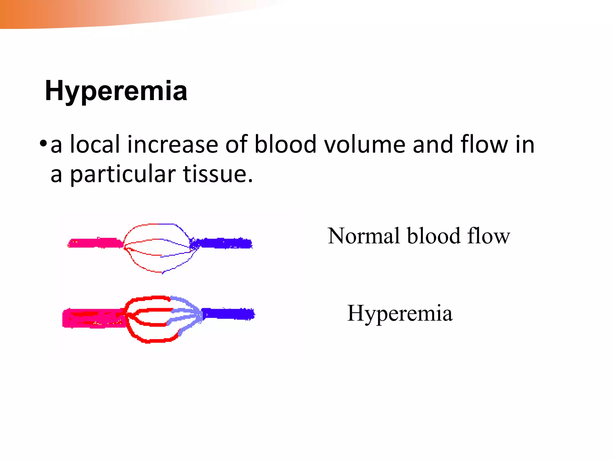 Hemodynamic disorders | PPT