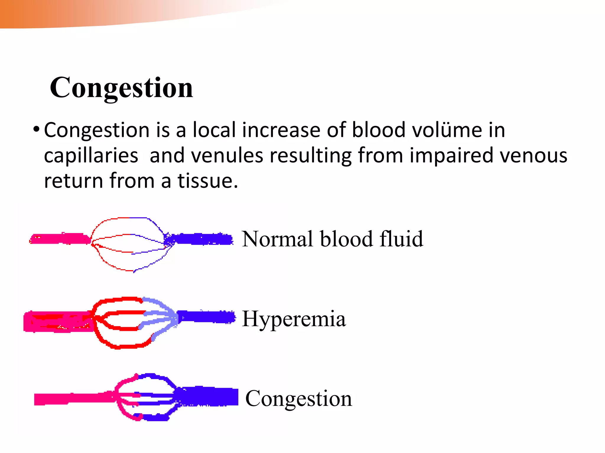 Hemodynamic disorders | PPT