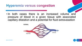 Hemodynamic Disorders.pptx