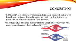Article on the Hemodynamic Disorders final edit.pptx