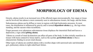Article on the Hemodynamic Disorders final edit.pptx