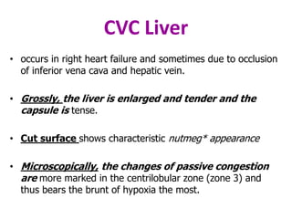 Hemodynamic disorders - Lecture-5 | PPTX