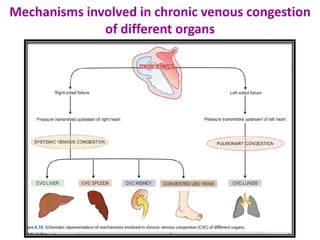 Hemodynamic disorders - Lecture-5 | PPTX