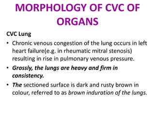 Hemodynamic disorders - Lecture-5 | PPTX