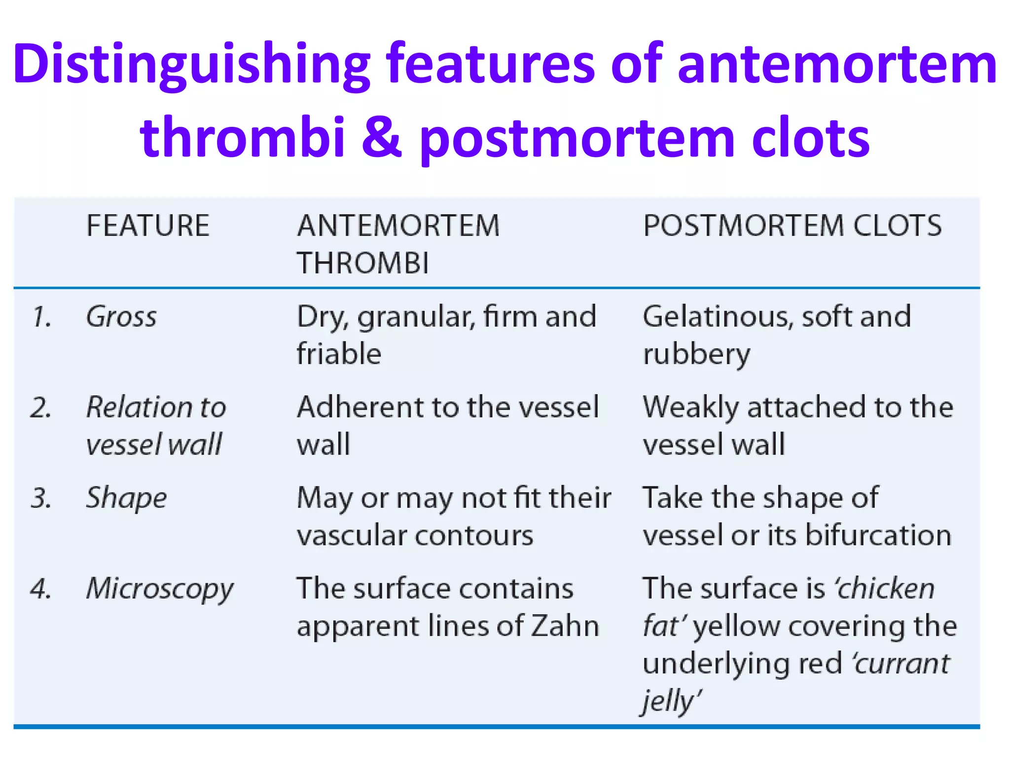Hemodynamic Disorders, Thromboembolic Disease & Shock-HYPERCOAGULABLE ...