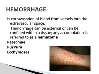 Hemodynamic & Haemostasis Disturbances.pptx