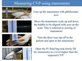 Hemodynamic monitorig | PPTX