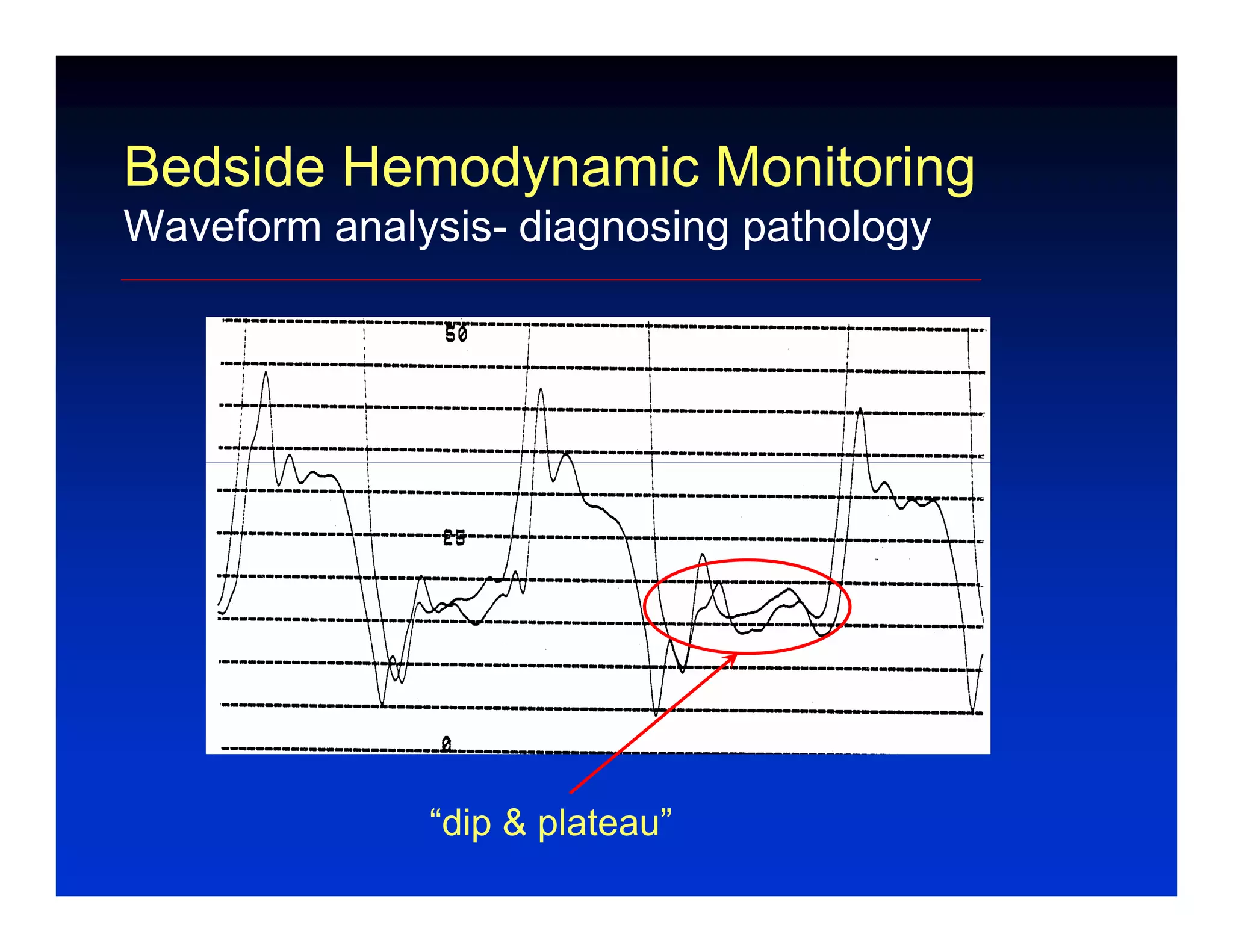 Hemodynamic monitoring | PPT