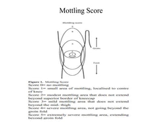 Hemodynamic monitoring | PPTX