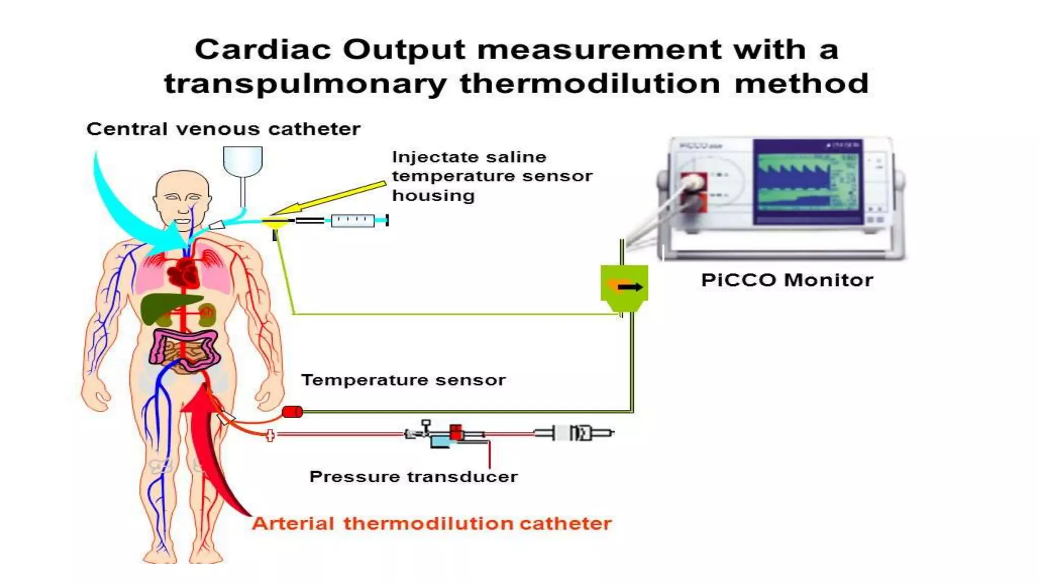 Hemodynamic monitoring | PPTX