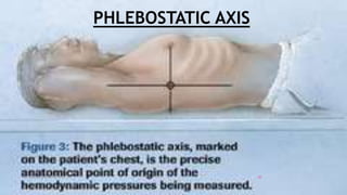 Hemodynamic monitoring | PPTX