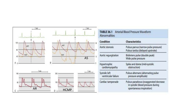 Hemodynamic monitoring.pptx | First Aid | Injuries